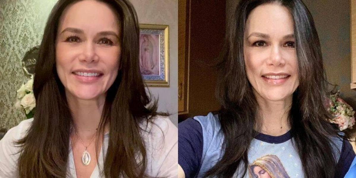 Amada Rosa Pérez: actriz revela difícil momento que pasa por biopolímeros