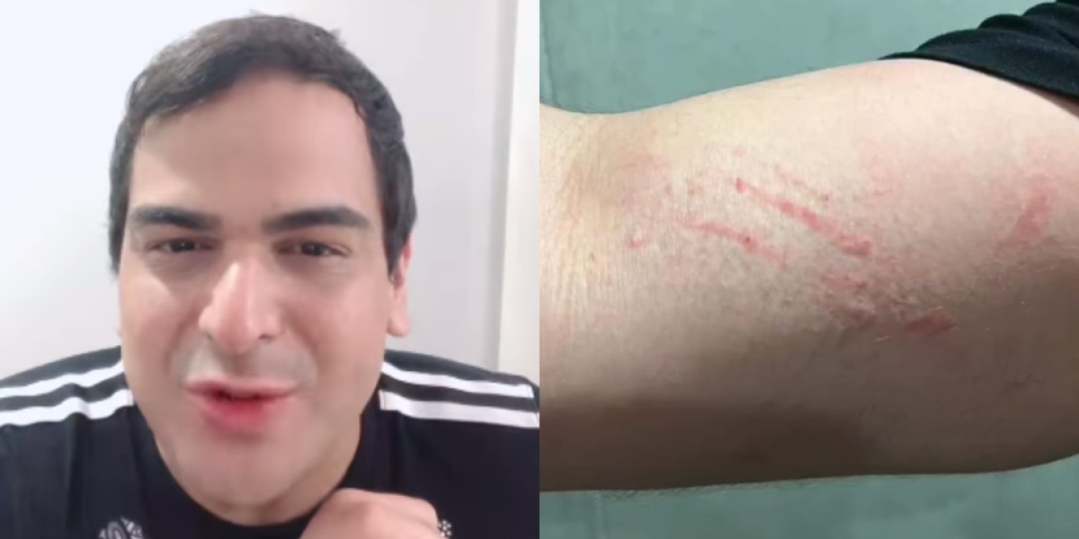 Alejandro Palacio sufrió un altercado en concierto de Ricardo Arjona