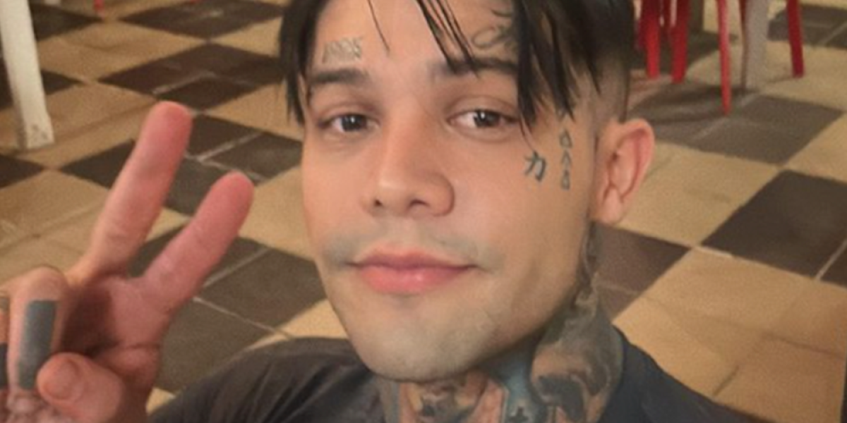 Yeferson Cossio se está borrando los tatuajes de la cara