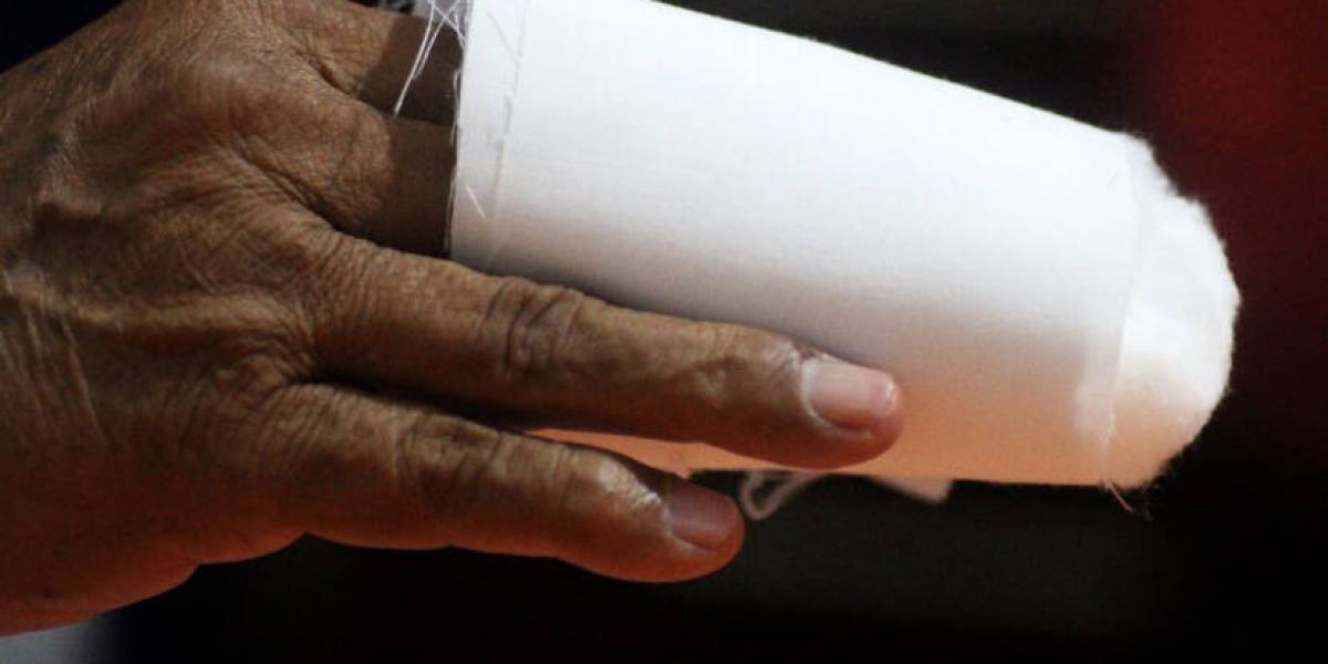 Primera persona quemada por pólvora en el Meta