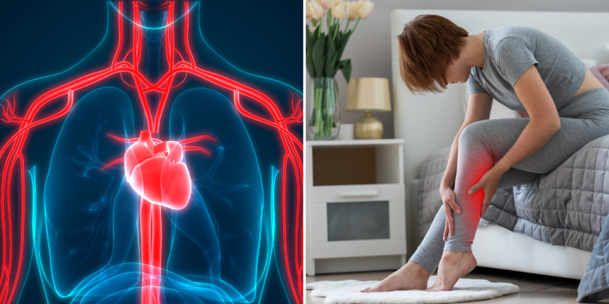 ¿Tiene mala circulación? Conozca la solución y posibles causas