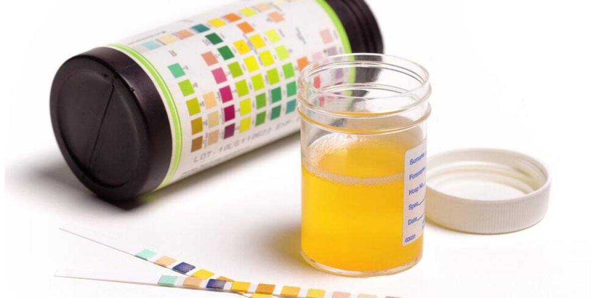 Cistitis: qué es, síntomas y signos de alarma