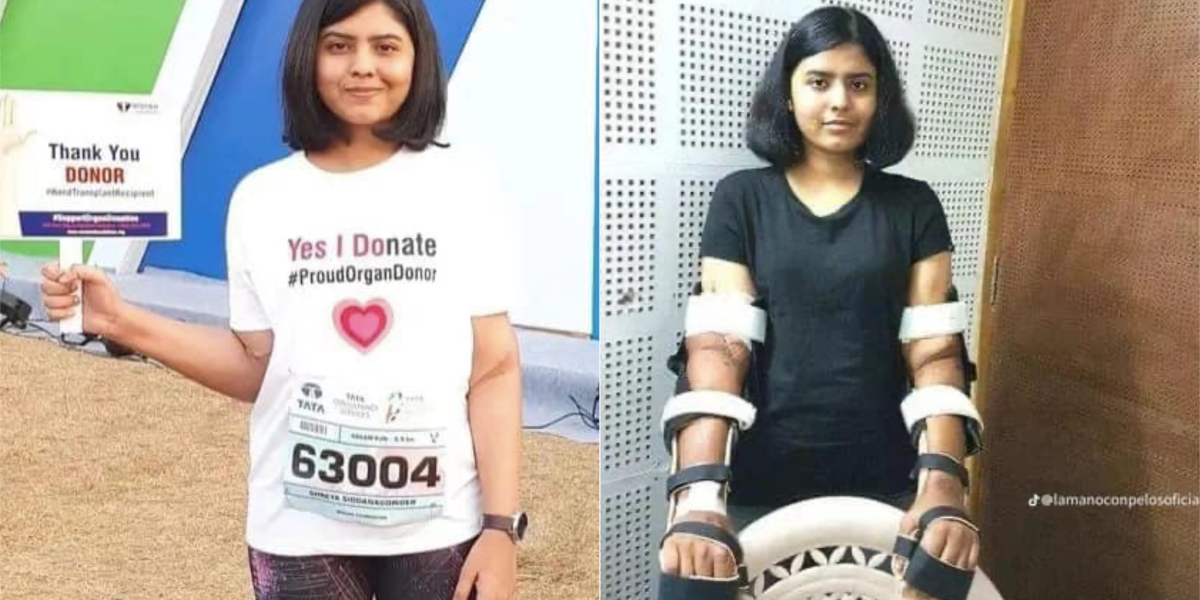 Shreya Siddanagowder: la joven que recibió trasplante de manos de un hombre