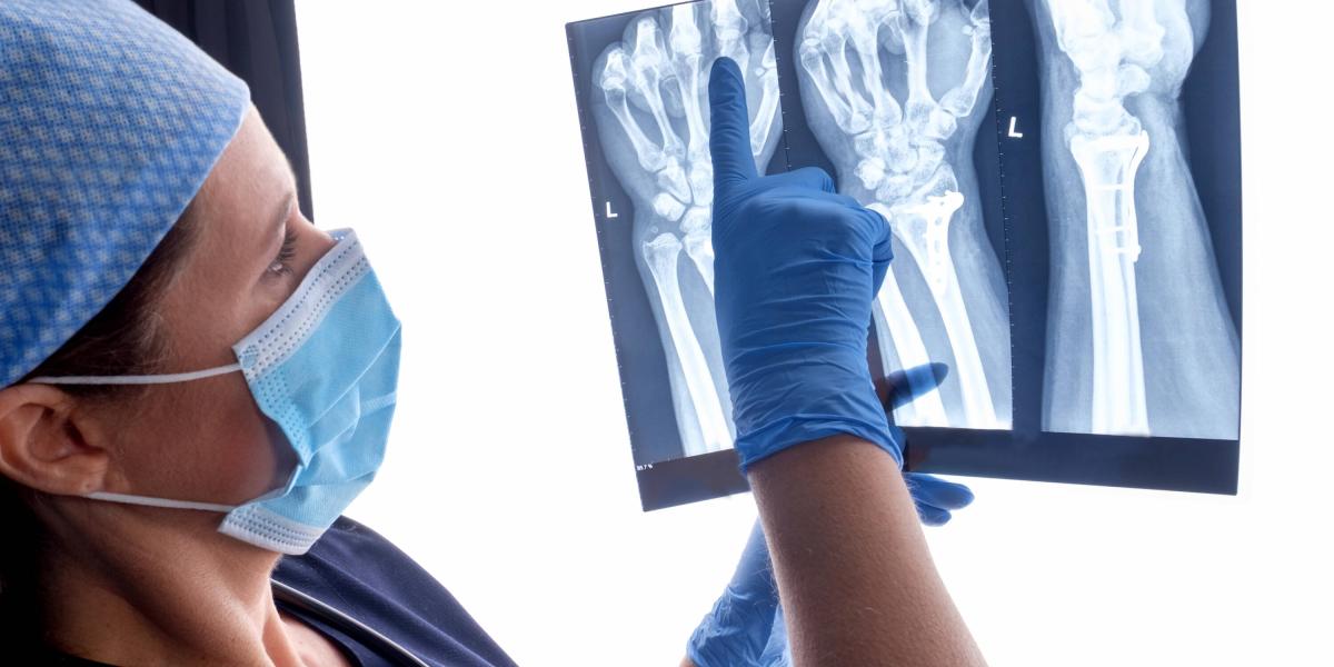 ¿Cómo saber si tiene una mano fracturada y cuál es su tratamiento?