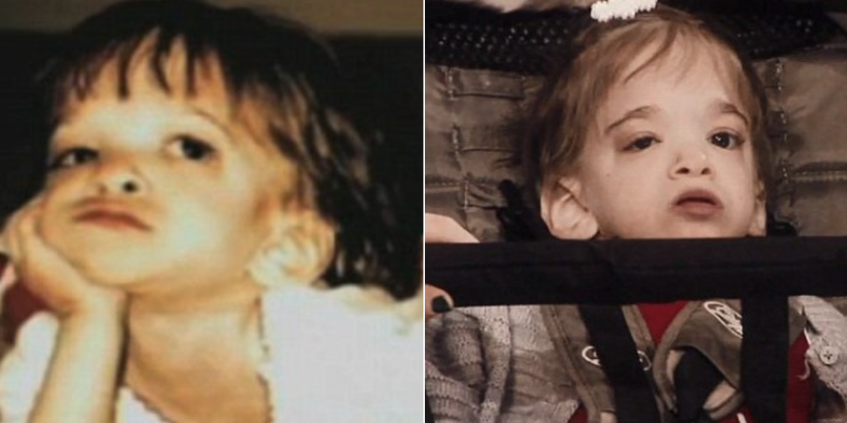 Brooke Greenberg: la bebé eterna que vivió 20 años en el cuerpo de una niña