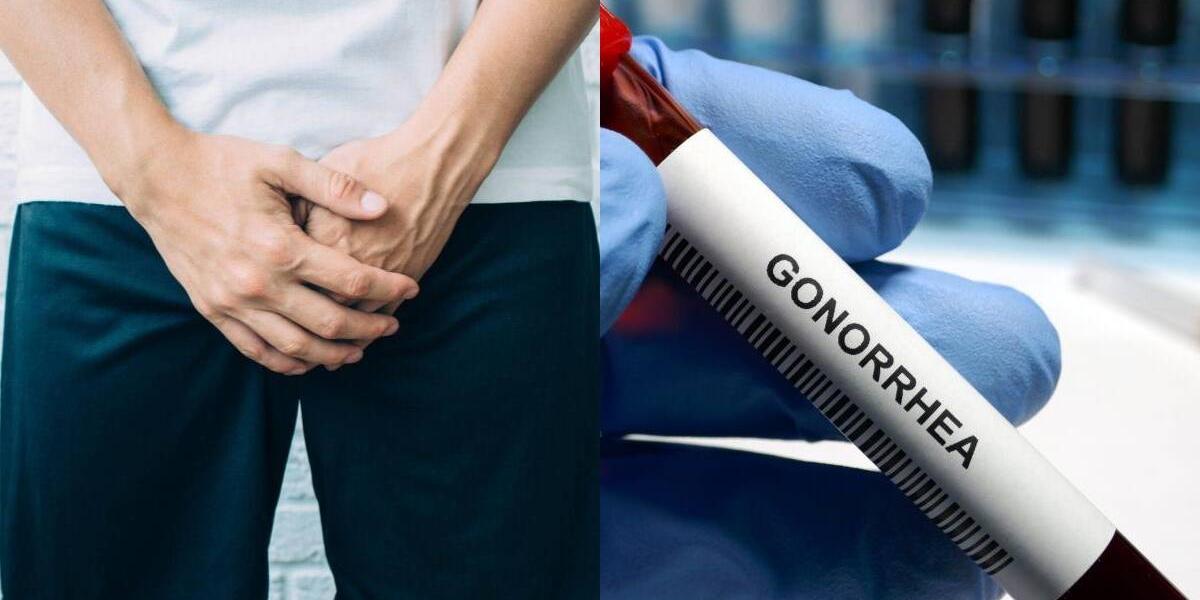 Gonorrea: estos son los síntomas de la enfermedad y sus posibles ...