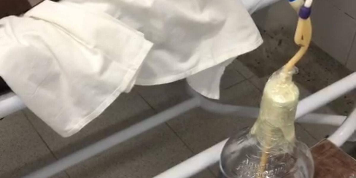 Con 'garrafa de guaro' salvan la vida de paciente: así es ser médico ...