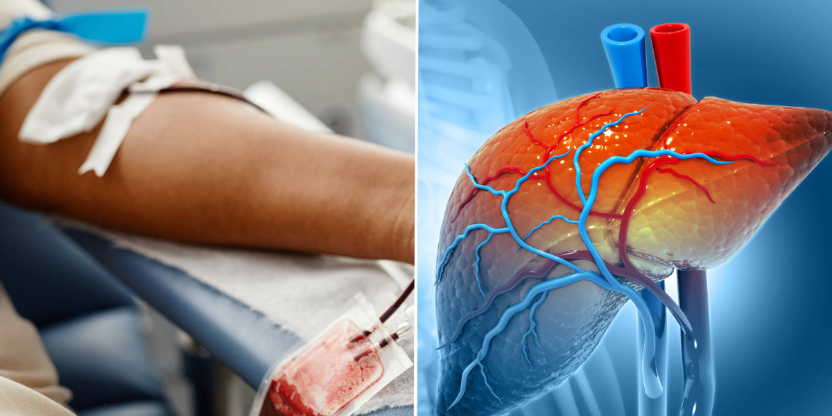 Gamma-glutamil transpeptidasa GGT alto: ¿cómo se realiza prueba y qué ...