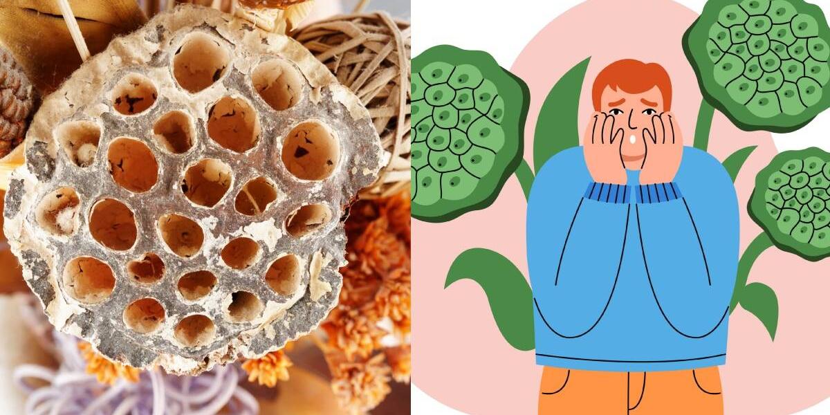 Tripofobia en niños: ¿cuáles son sus causas y qué síntomas presentan?