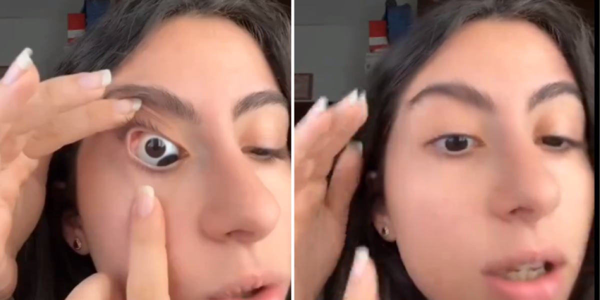 Video: mujer con tres ojos impacta al mundo; tiene otro color