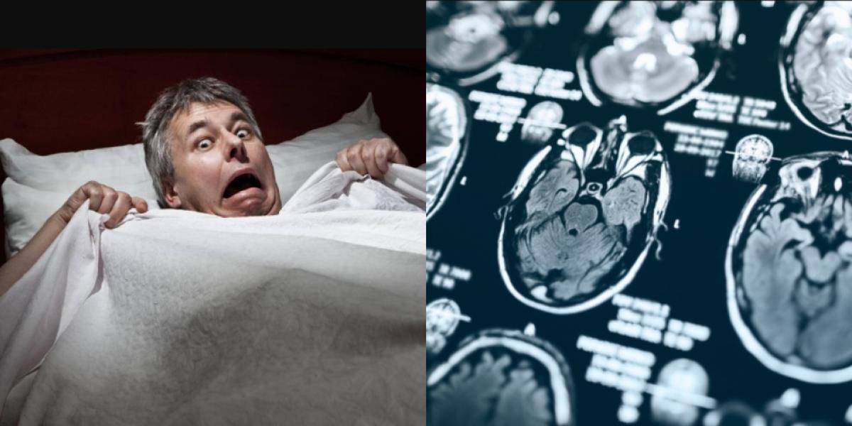 Pesadillas y alucinaciones 'podrían ser una señal de advertencia de una ...