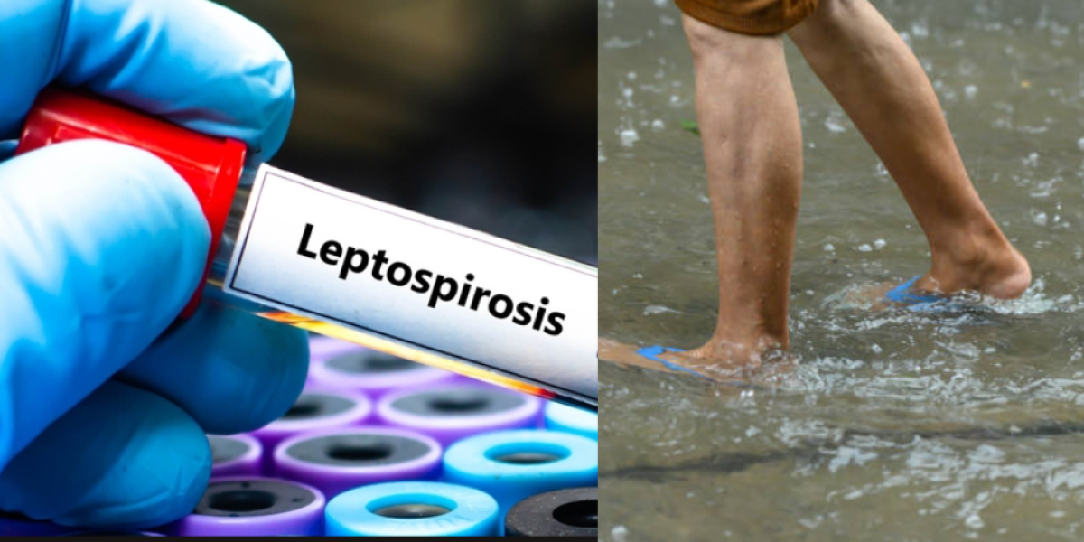 Leptospirosis: qué es la 'enfermedad de las inundaciones' que dejó dos ...