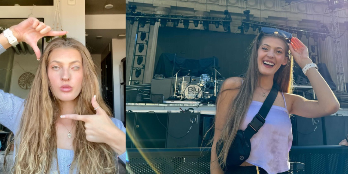 La joven que vive con un raro síndrome que afecta a uno en un millón ...