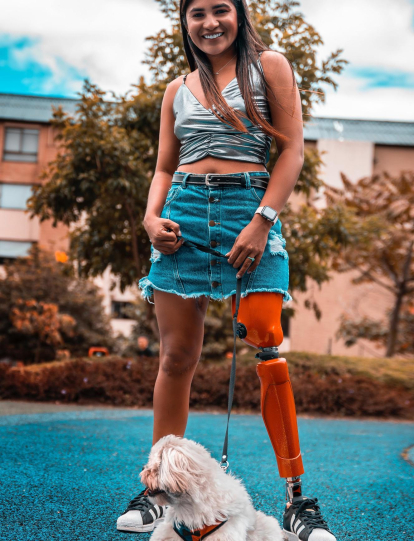 Johanis Menco, una guerrera que ganó otra batalla, su pensión de invalidez: ‘Soy heroína de mí ...