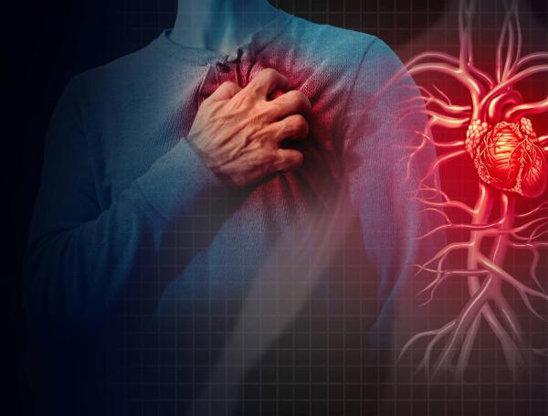 Las diferencias entre un ataque y un paro cardiaco: lo que debe saber ...