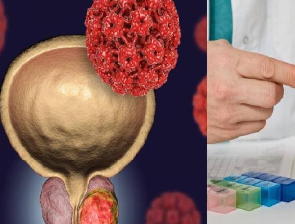 Prostatectomía parcial, la técnica mínimamente invasiva que ayudaría a ...