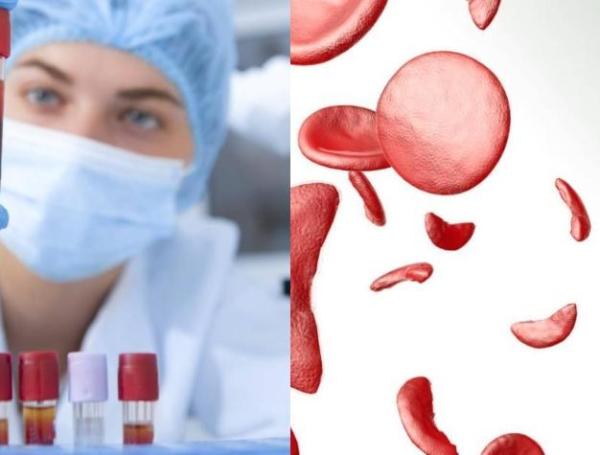 Beneficios del nanche: estas son las enfermedades que ayuda a combatir