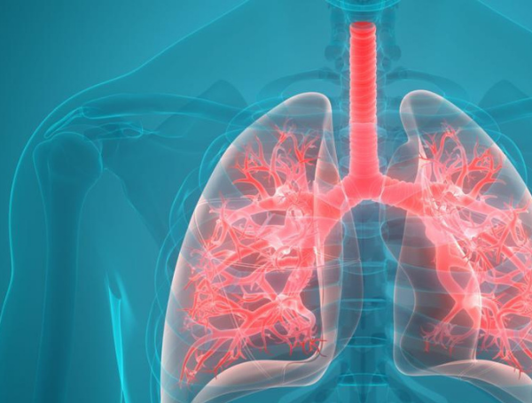 Salud del papa Francisco | ¿Qué es la bronquiectasia y cómo afecta recuperación tras últimas ...