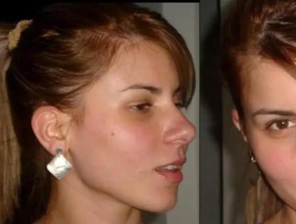 Psiquiatra reaccionó al caso de Ingrid Karina, asegura que la forma en ...