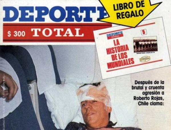 La historia del Cóndor Rojas con el incidente de la Selección de Chile ...
