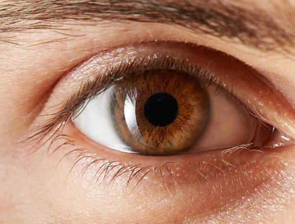 Cómo identificar el cáncer de ojo de manera temprana: estos son sus ...