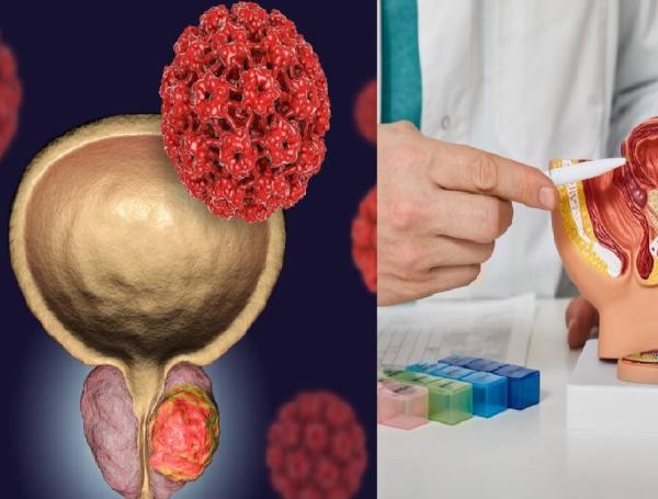 Cáncer de próstata: cinco hábitos saludables para prevenir su aparición