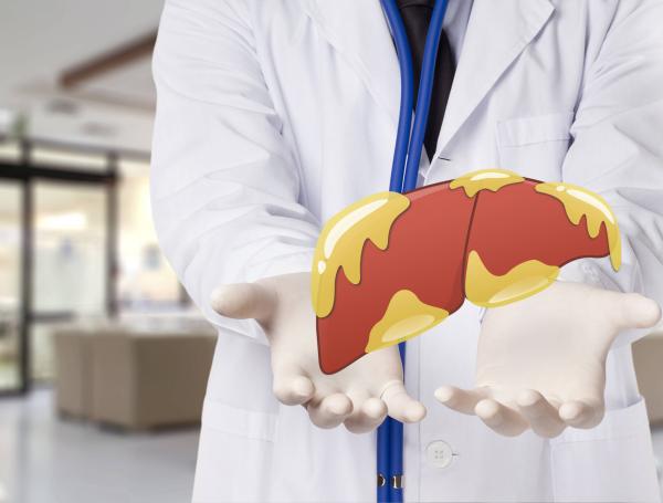 Gamma-glutamil transpeptidasa GGT alto: ¿cómo se realiza prueba y qué ...