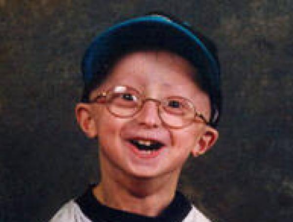 Sam Berns, el adolescente con envejecimiento prematuro que murió en EE. UU.