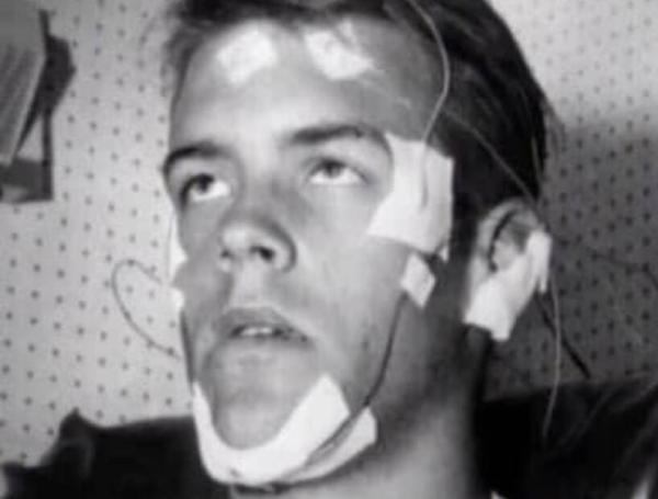 Randy Gardner: la historia del joven que pasó 11 días sin dormir por un ...