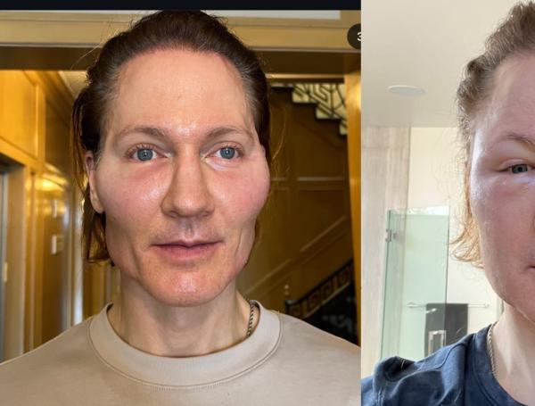 El multimillonario creador de Blueprint, proyecto de longevidad, se ...