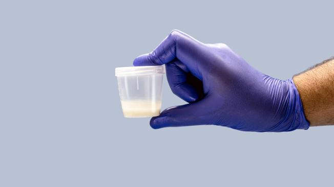 Color del semen: trasparente, amarillo, rojo y blanco ¿qué dicen sobre la salud?