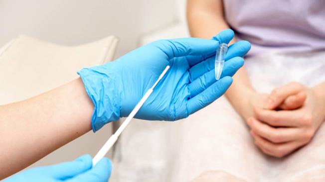 Papiloma humano en mujeres: Tratamiento del VPH y su relación con el cáncer