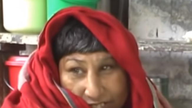 ‘Niños ratas’: Tradición pakistaní que malforma niños y los explota