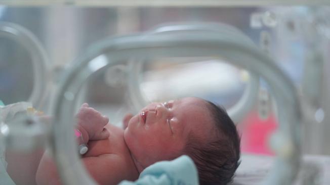 Bebé con cola de casi seis centímetros: foto del caso que impactó a médicos