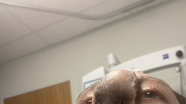 Trinity Rowles:sufrió lesión en la cara y ahora tiene pelo en toda la nariz