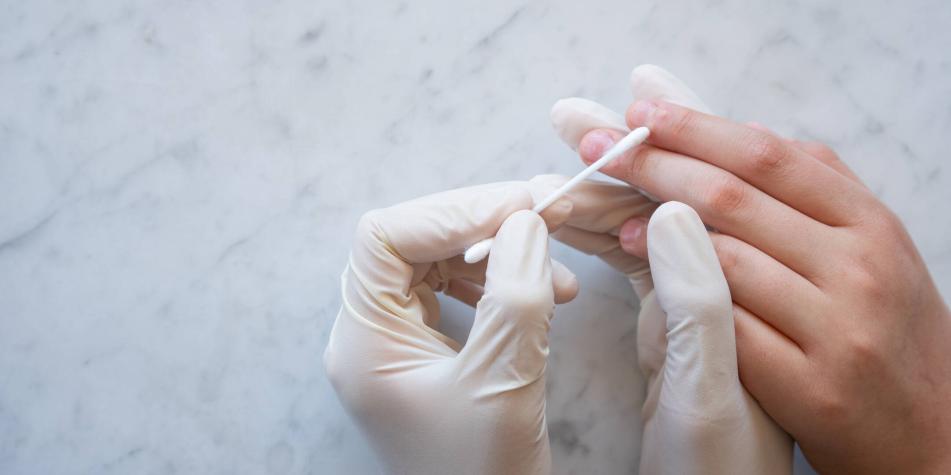 ¿Por qué salen los mezquinos? Así los puede tratar