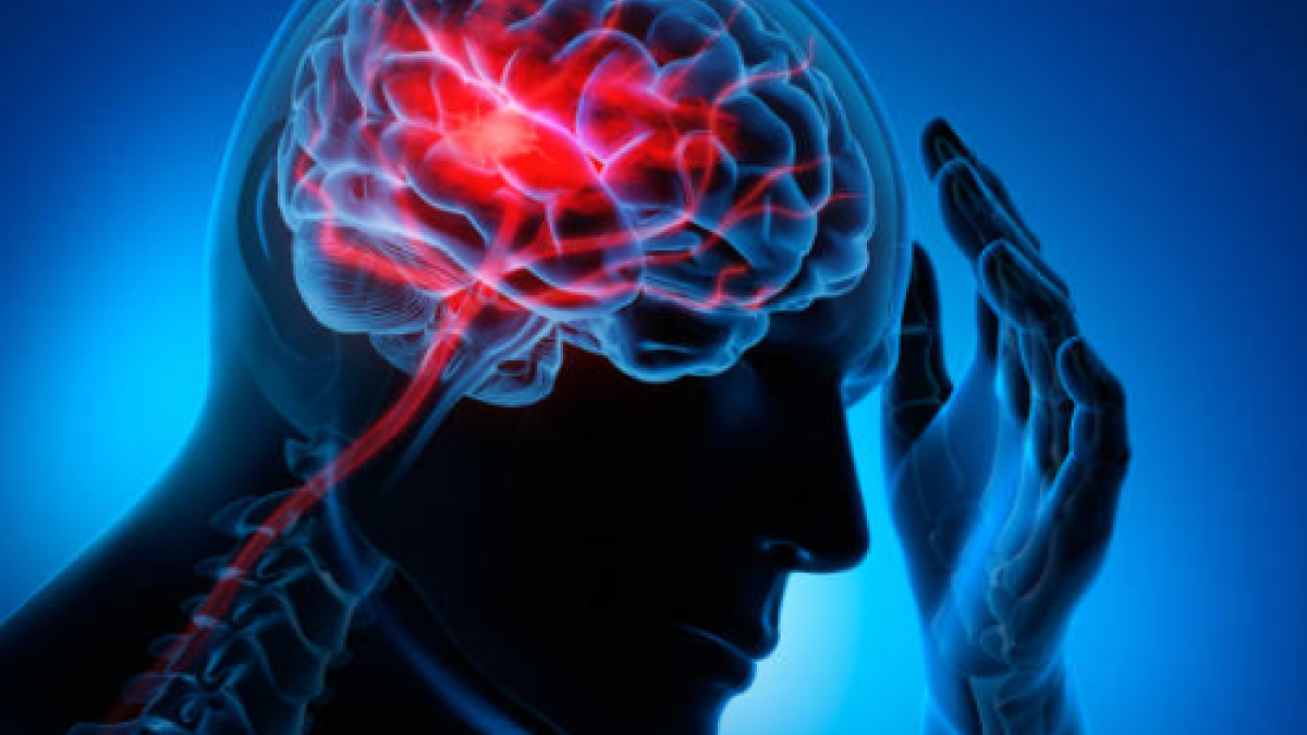 Muertes por accidente cerebrovascular ACV en Colombia