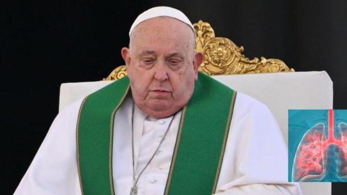 Síntomas y signos de alerta de la neumonía bilateral, enfermedad que padece el papa Francisco
