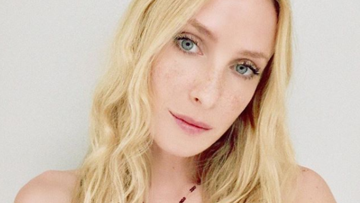 Qué es el quimerismo que padece la modelo Taylor Muhl