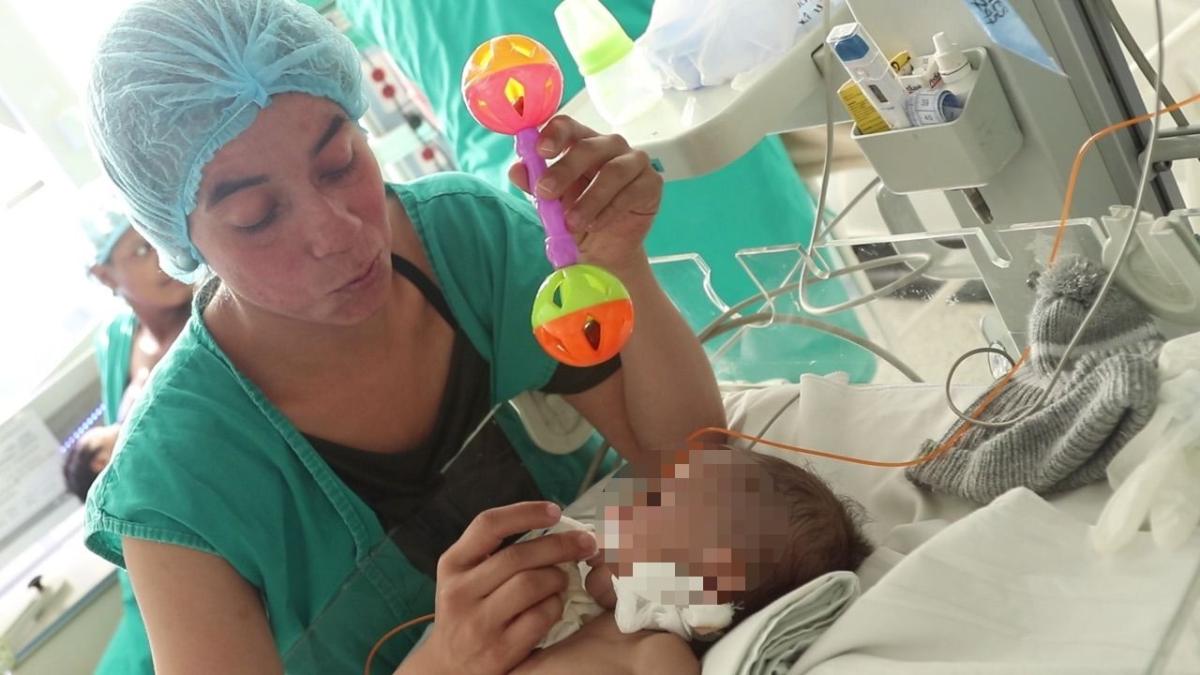 Así salvaron la vida de un bebé que nació con los intestinos expuestos