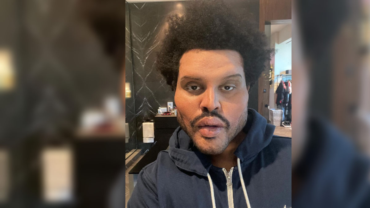 Cirugía Plástica ¿Qué le sucedió a The Weeknd en la cara?