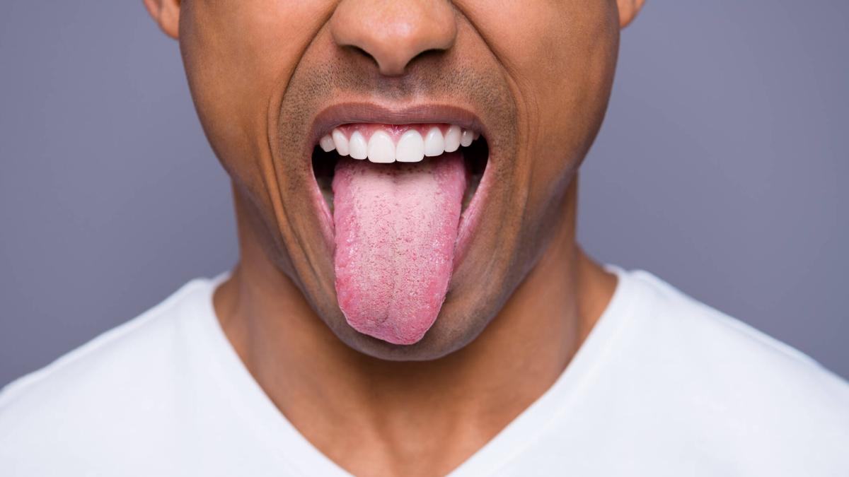 ¿De qué color debe ser la lengua? Esto dice Harvard sobre señales de ...