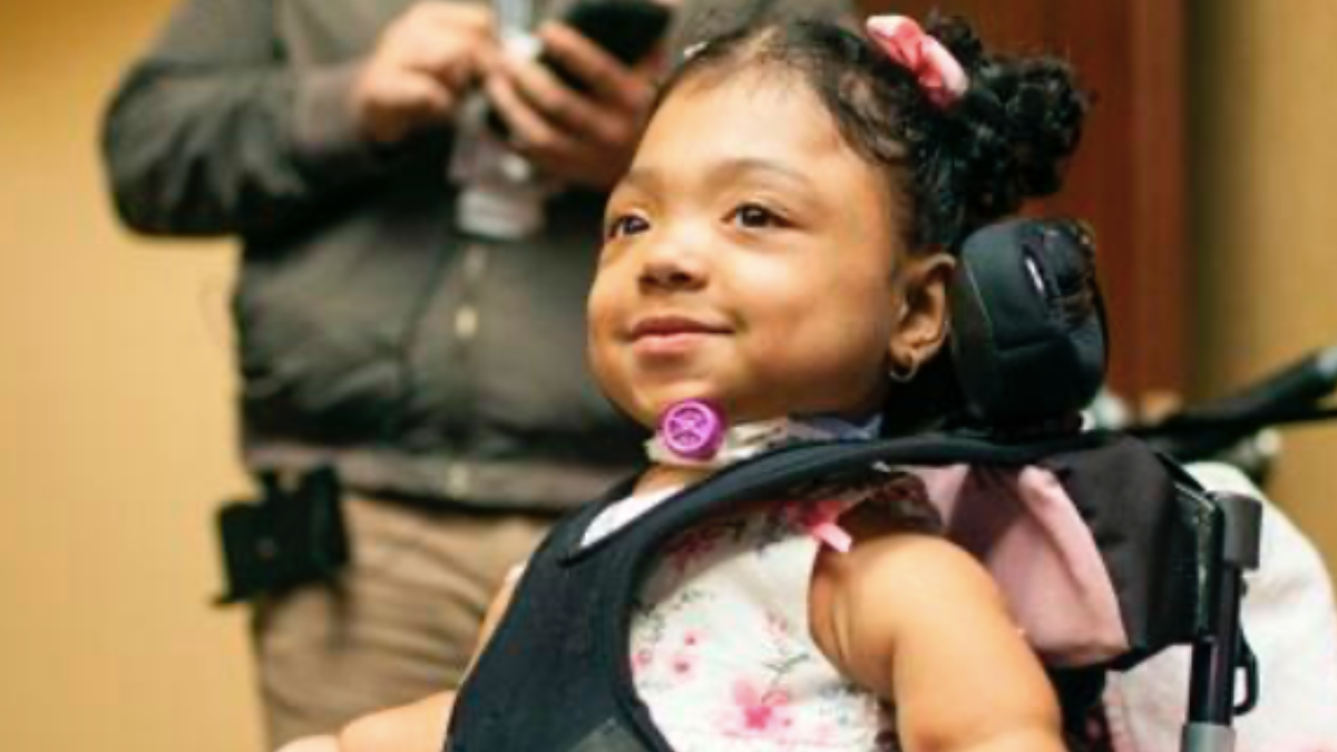 Janelly, la niña que con hipofosfatasia que nació sin huesos en Estados ...