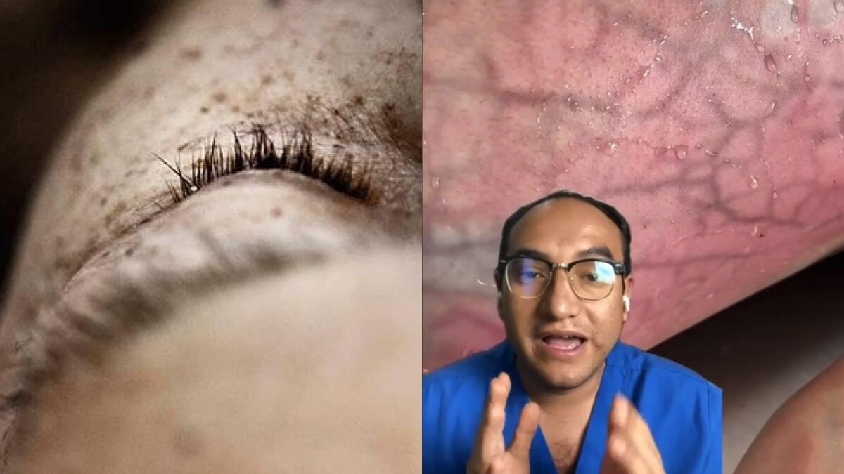 ¿Cómo es la descomposición de un cuerpo humano? Un médico lo describe ...