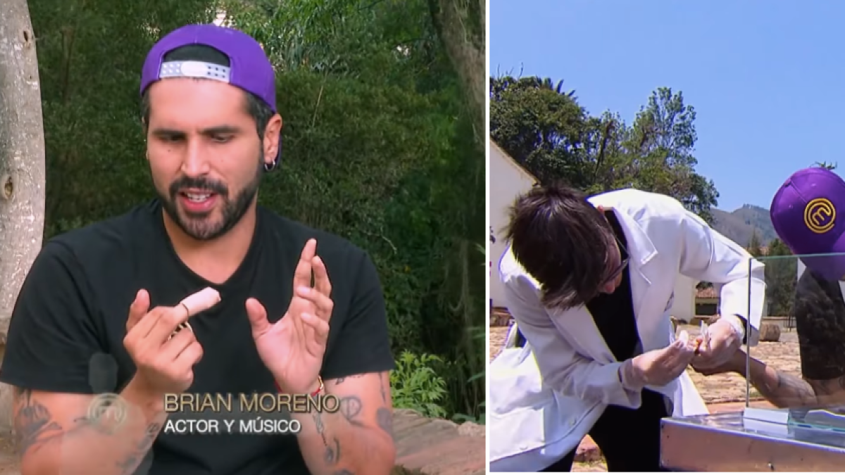 Brian Moreno sufre accidente en la cocina de 'MasterChef Celebrity ...