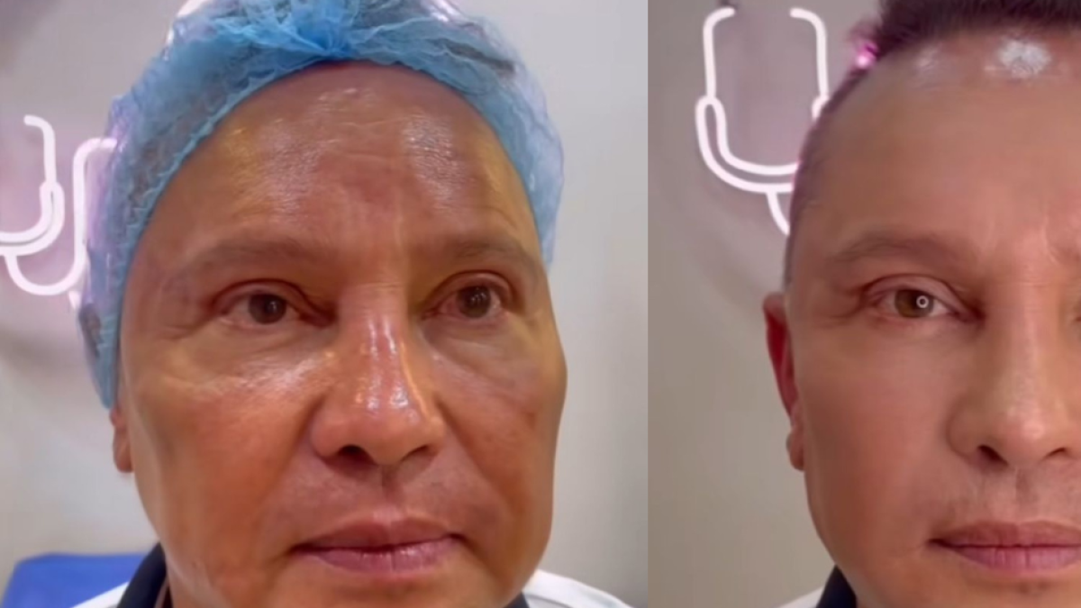 Giovanny Ayala sorprendió con su drástico cambio de imagen tras ...