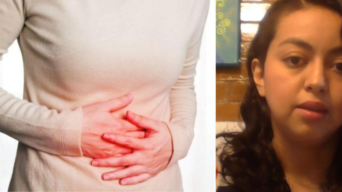 Tenía el abdomen inflamado, le extirparon el bazo y años después le ...