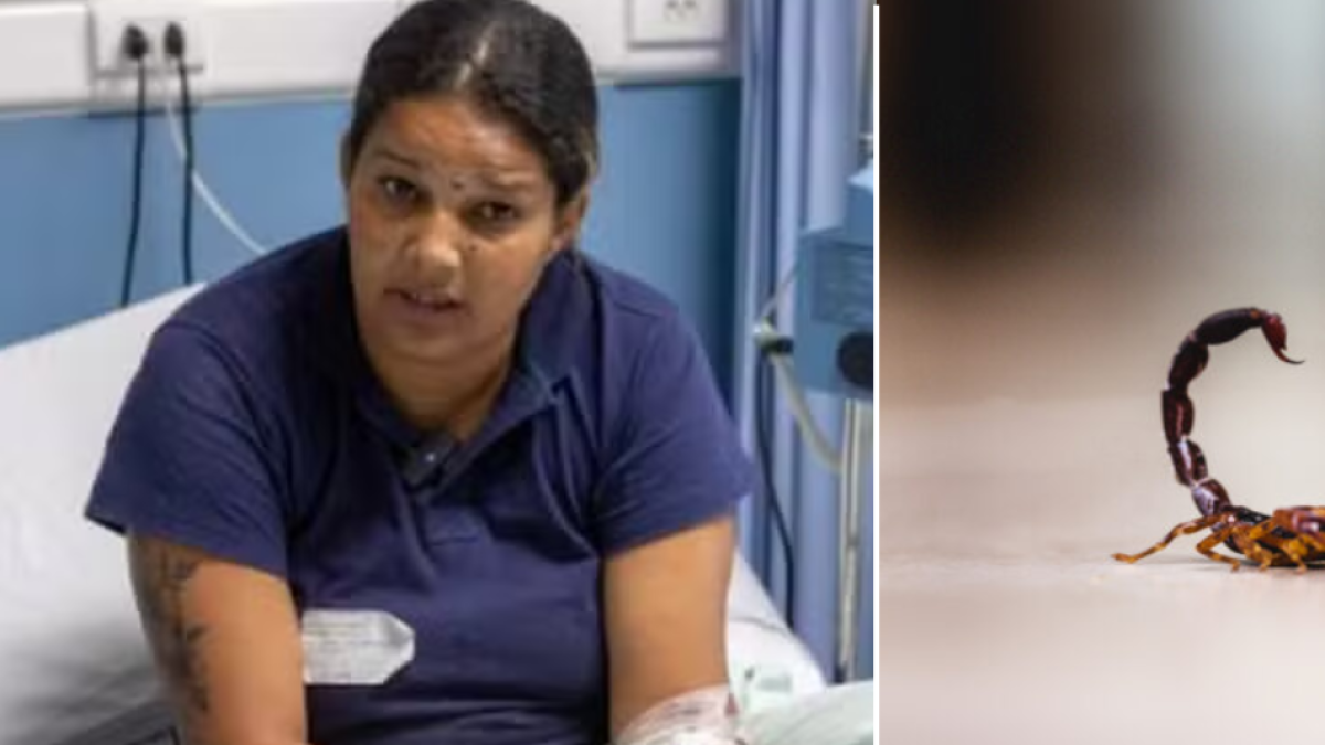 Mujer fue picada por el escorpión más venenoso de Sudamérica: el animal ...