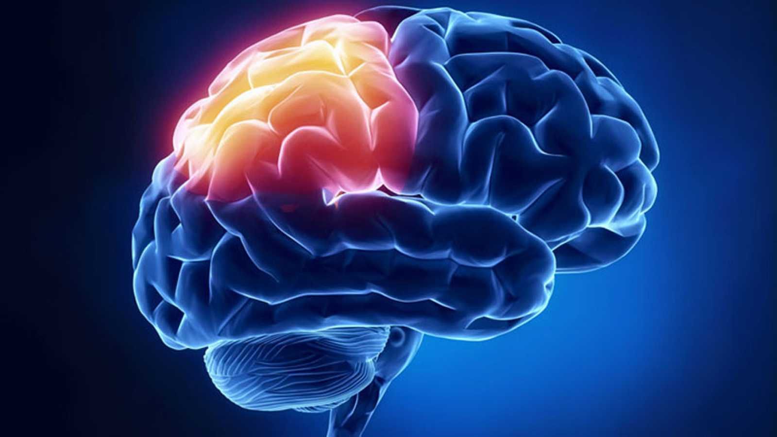 ACV: ¿cómo reconocer y actuar rápidamente ante un ataque cerebrovascular?