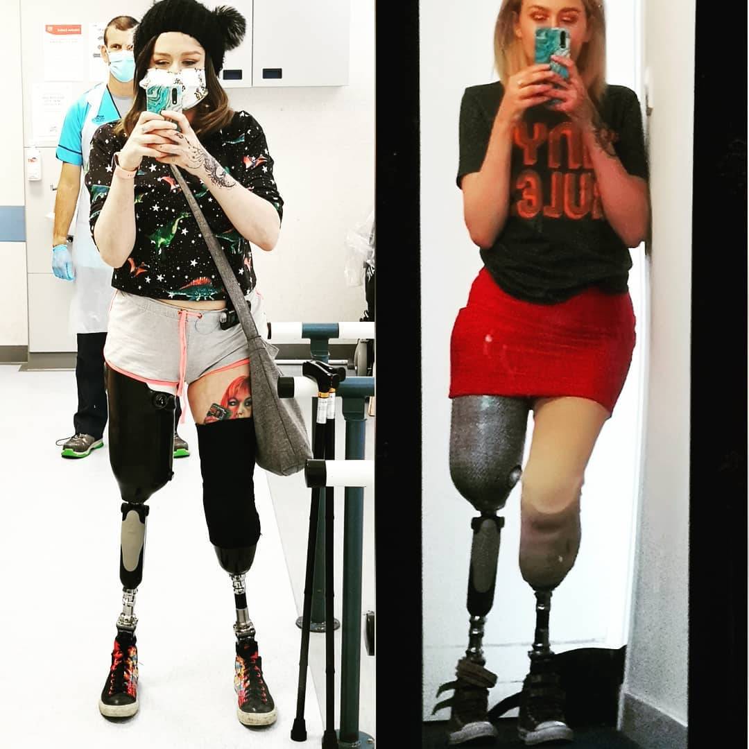 Daniela Álvarez y reconocidos modelos con amputaciones